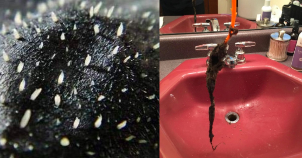 35 Products That'll Possibly Reveal Disgusting Things About Your Body ...