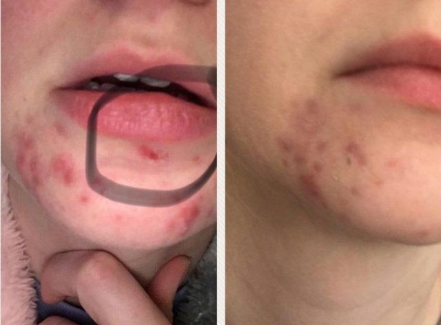 37 Before and After Product Photos That'll Make You Say, "Gross. I Can ...