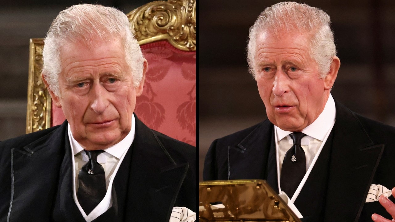 Doctor Reveal Why King Charles' Fingers Appear Swollen and Red