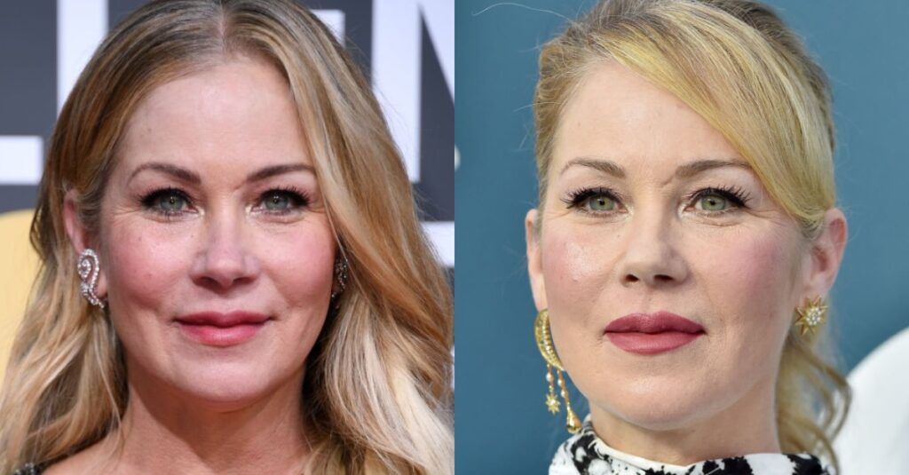 Christina Applegate Says 'Dead to Me' Role Is Likely Her Last Acting Job