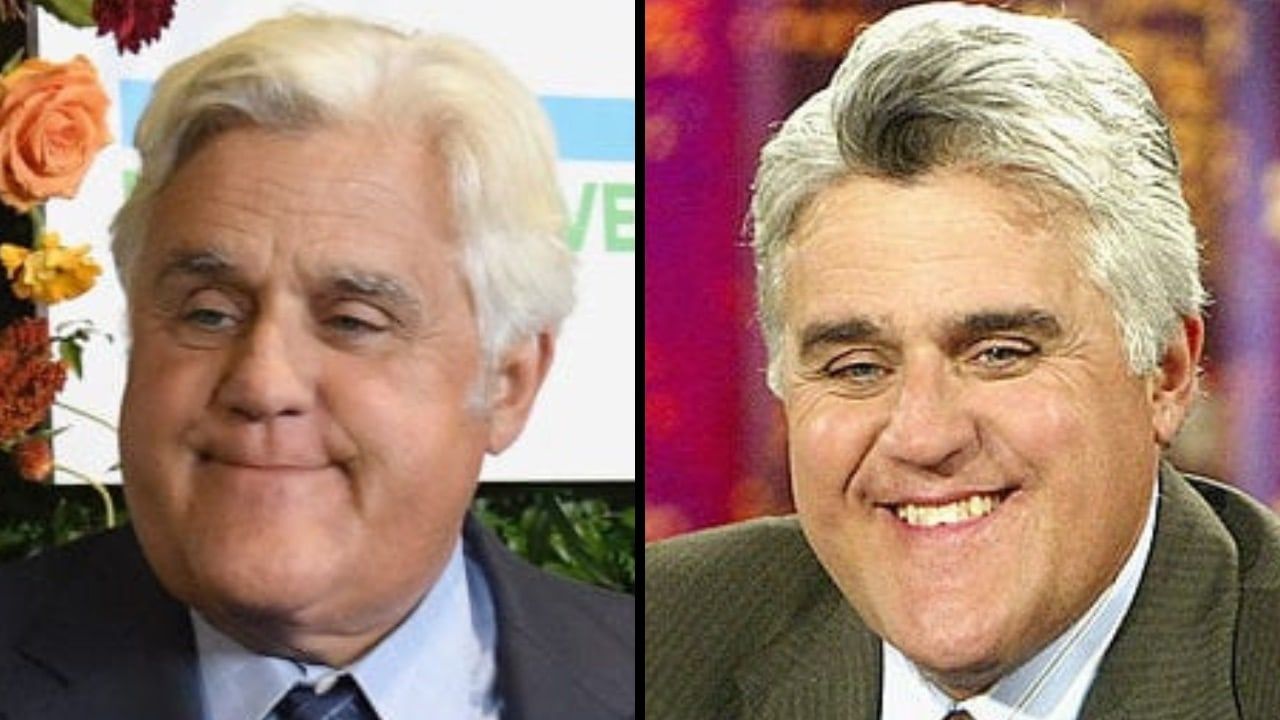 Jay Leno Pictured for First Time Since Serious Burns From Gasoline Fire
