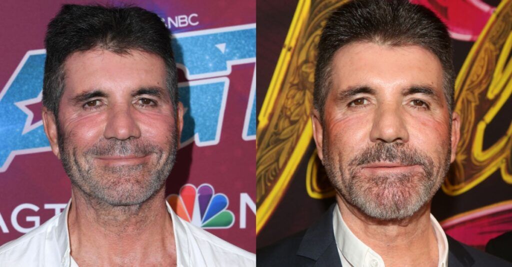 Simon Cowell Leaves Fans Baffled With His Radically Different Facial ... Simon Cowell Leaves Fans Baffled With His Radically Different Facial ...