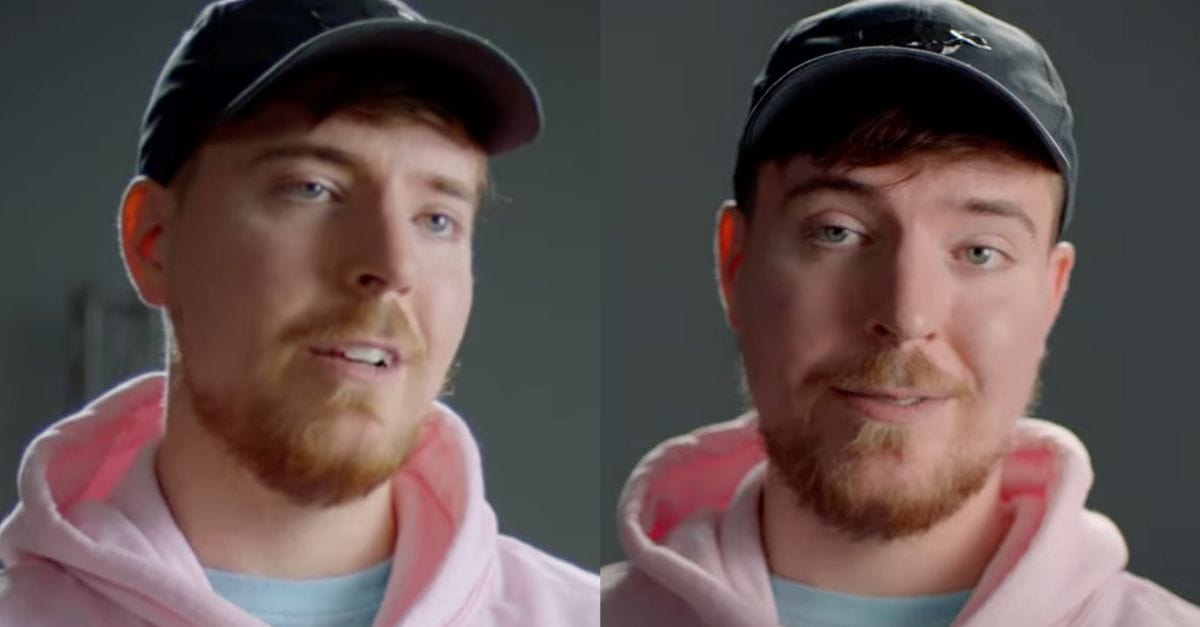 The Incurable Disease That MrBeast Lives With Everyday