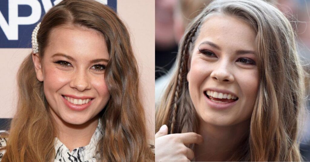 Bindi Irwin Undergoes Huge Surgery After Enduring 'Insurmountable Pain’
