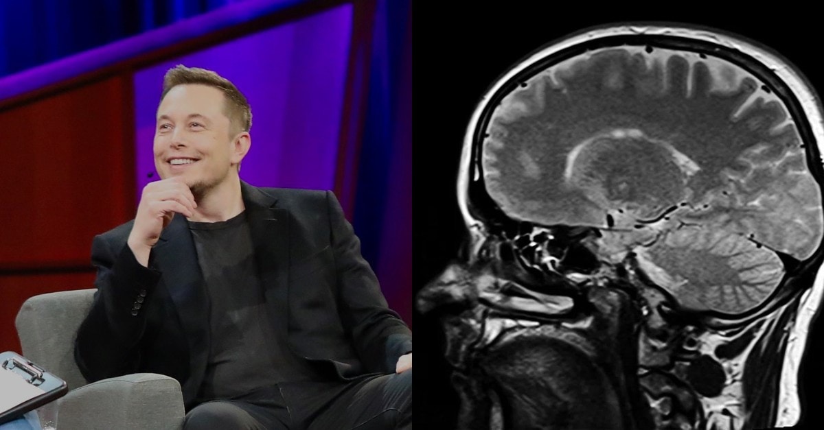 Elon Musk’s Company Neuralink Looking For First Volunteer To Have Robot ...